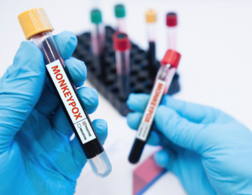 OMS recomenda mudança do nome de varíola dos macacos para mpox